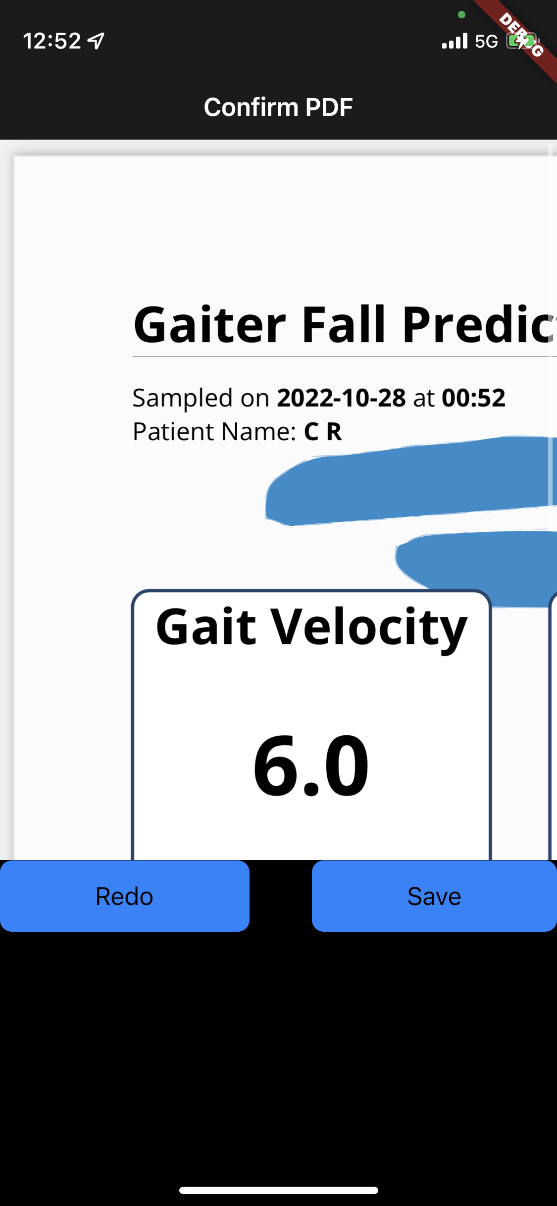 PDFView generated half zoomed view · Issue #210 · endigo/flutter_pdfview · GitHub