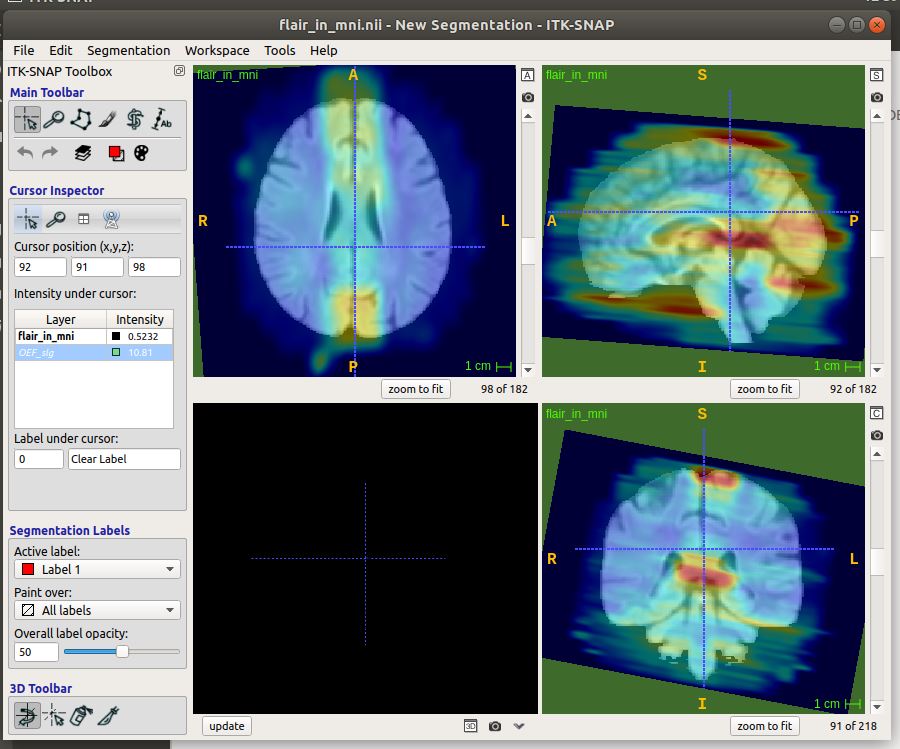 Registering a floating quantitative map to a T1 image by ANTs? · Issue #994 · ANTsX/ANTs · GitHub