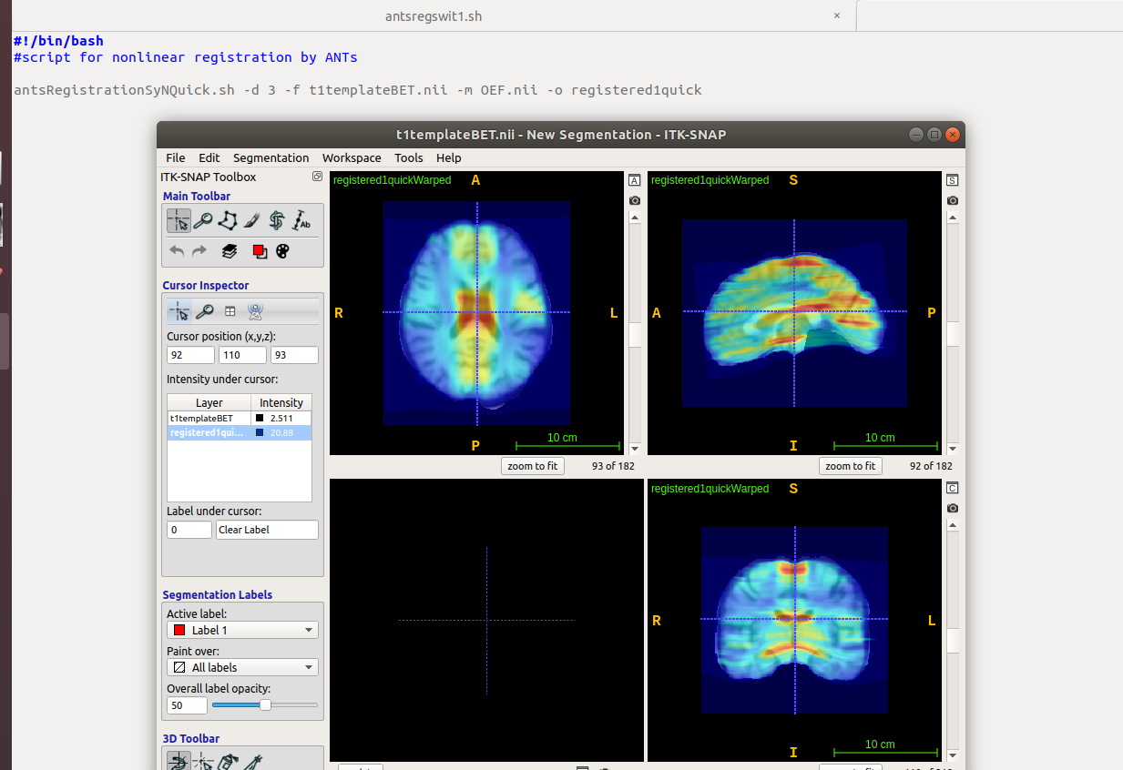 Registering a floating quantitative map to a T1 image by ANTs? · Issue #994 · ANTsX/ANTs · GitHub