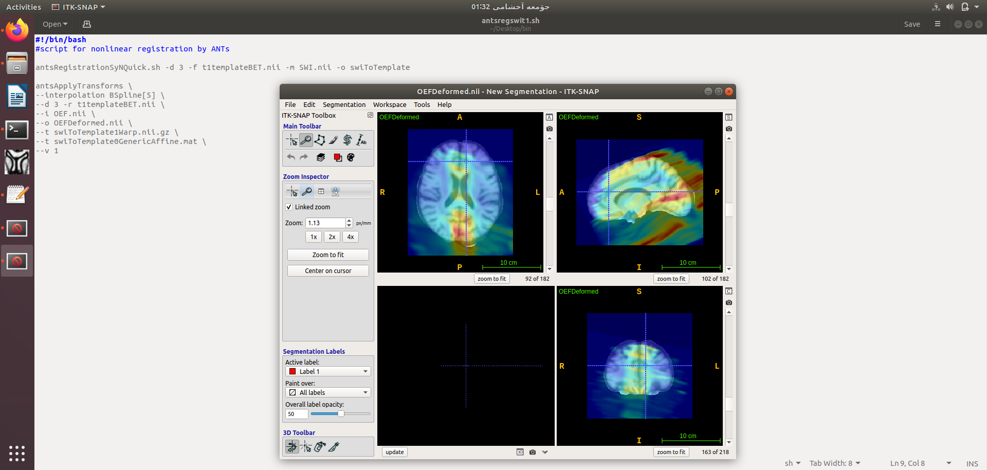 Registering a floating quantitative map to a T1 image by ANTs? · Issue #994 · ANTsX/ANTs · GitHub