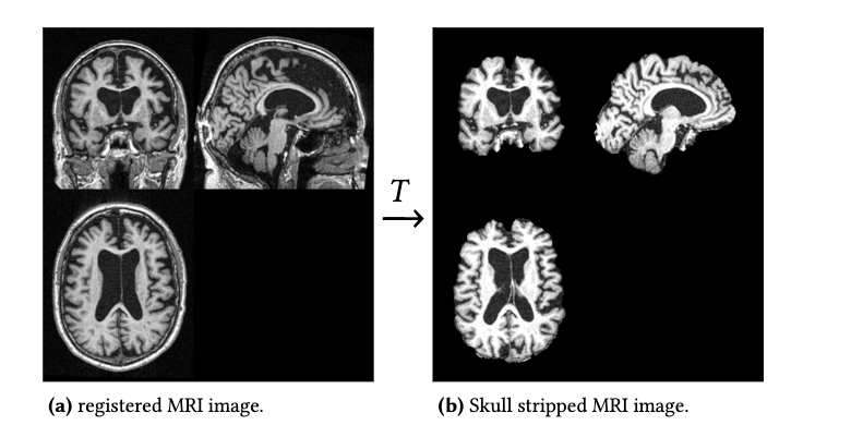 GitHub - AlexSisay/MRI-Retrieval: Retrieval of Brain MRI image