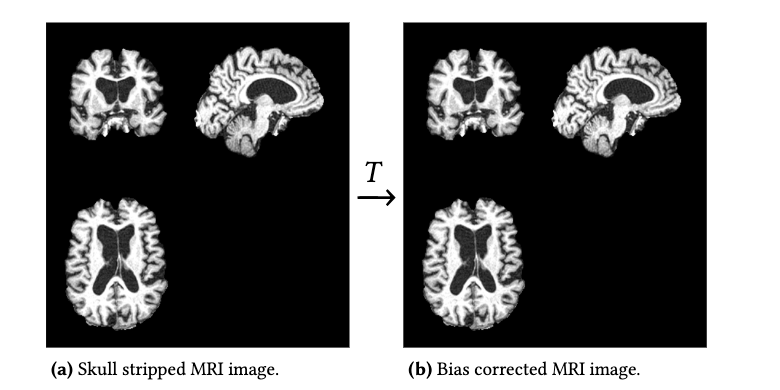 GitHub - AlexSisay/MRI-Retrieval: Retrieval of Brain MRI image