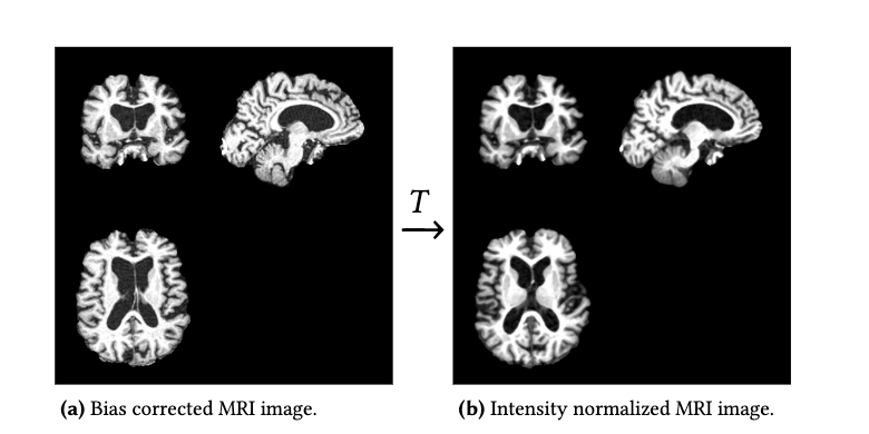 GitHub - AlexSisay/MRI-Retrieval: Retrieval of Brain MRI image