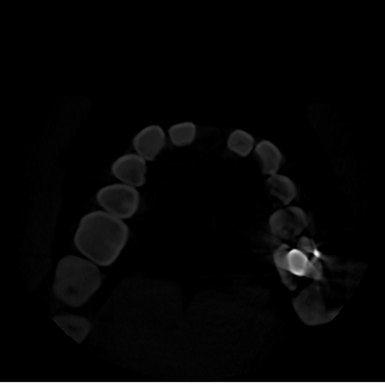 Trouble In Converting From Dicom To · Issue 1118 · Pydicom Pydicom · Github