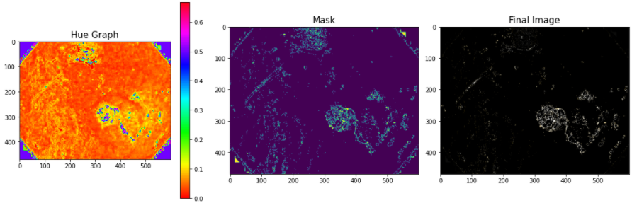Github Hich987 Ulcer Detection