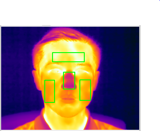 GitHub - svriit/Thermal-Facial-Landmarks-Detection