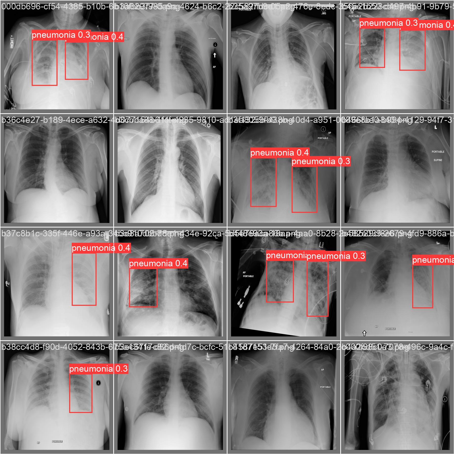 GitHub - KANGHANNARA/RSNA_Pneumonia_Detection
