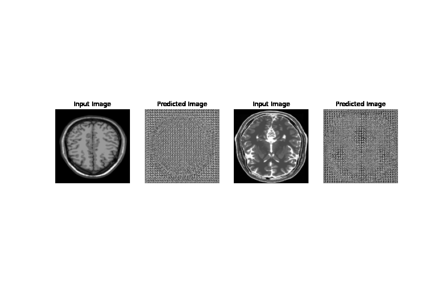GitHub - prasadmaharana/MRI_GAN