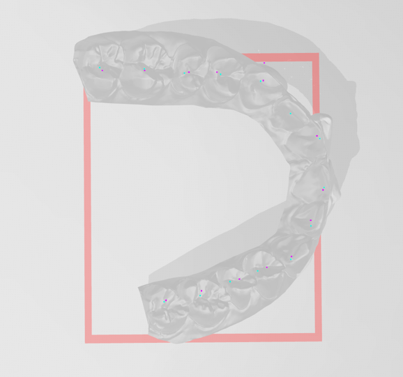 GitHub - snake-head/tsegnet: teeth instance segmentation