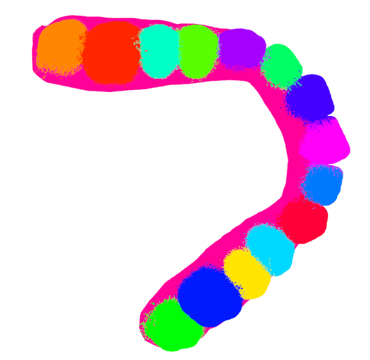 GitHub - snake-head/tsegnet: teeth instance segmentation