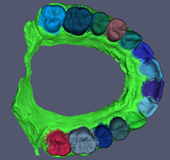 GitHub - snake-head/tsegnet: teeth instance segmentation