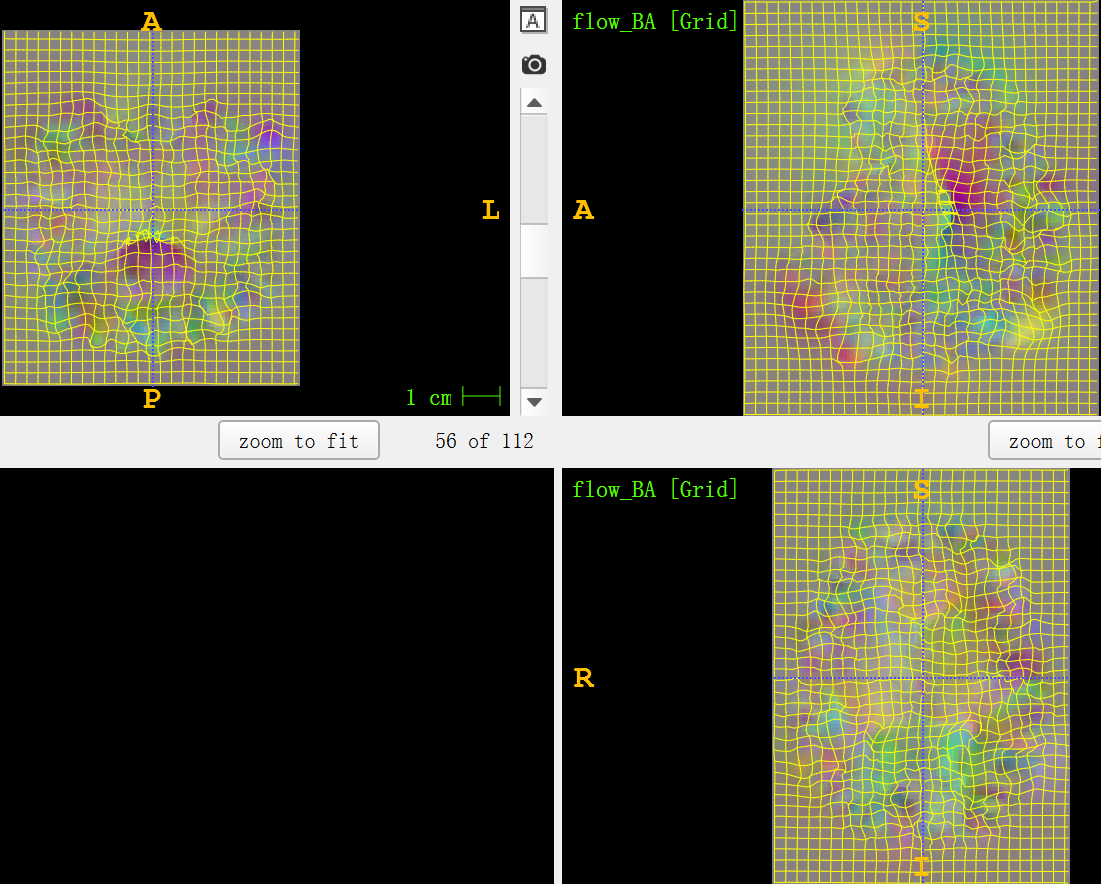 about dice · Issue #8 · cwmok/Fast-Symmetric-Diffeomorphic-Image-Registration-with-Convolutional ...