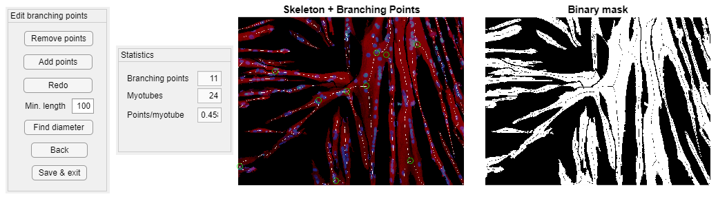 myotube-analyzer-app/Manual.md at main · SimonNoe/myotube-analyzer-app ...