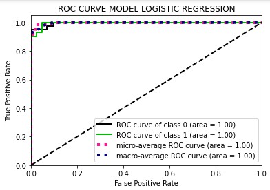 GitHub - DavidMartinez16/Breast-Cancer-Project: This is a data science ...