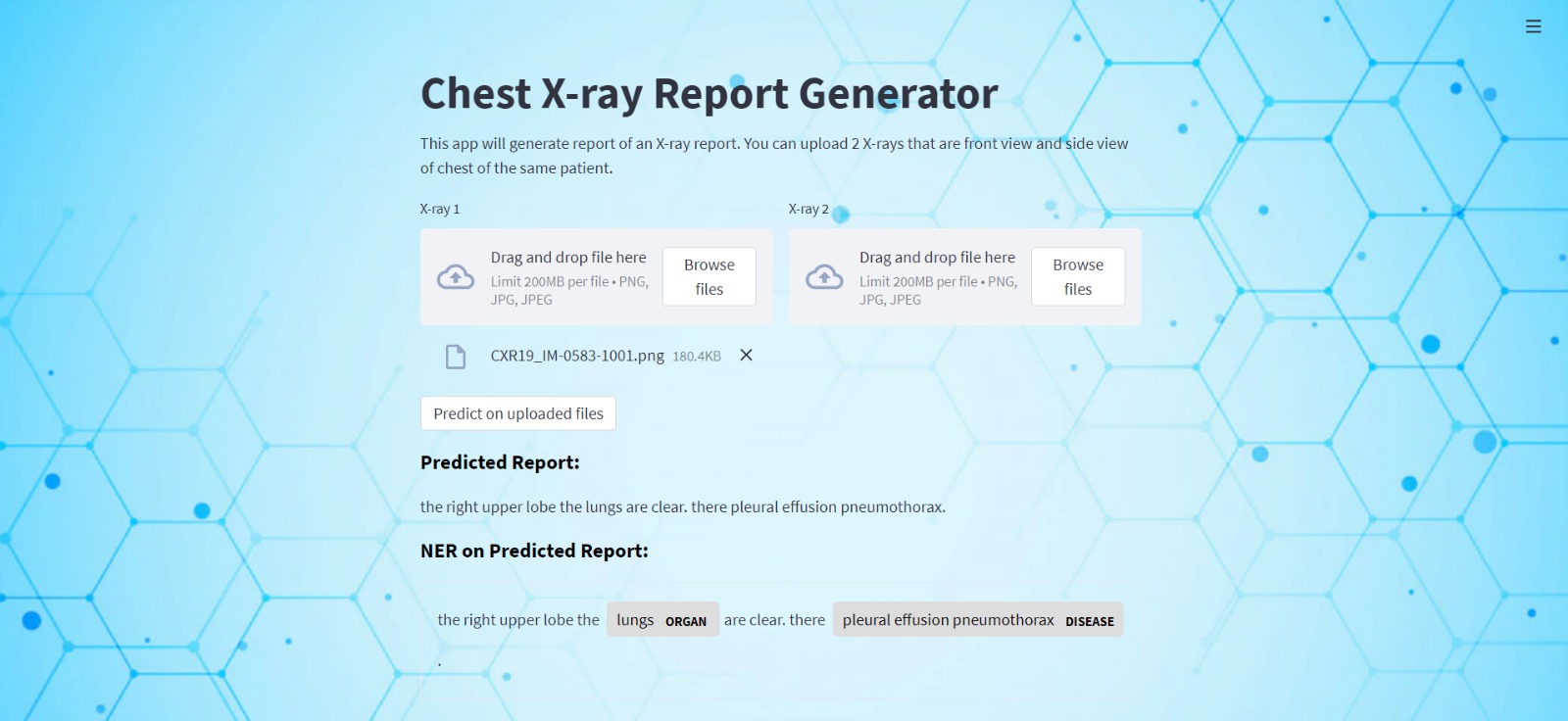 GitHub - Jhancyamarsingh17/Automated-medical-report-generation-and-NER
