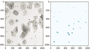 GitHub - paty237/cells-and-nucleus-segmentation-: projet d'imagerie 2021-2022/ codage en python