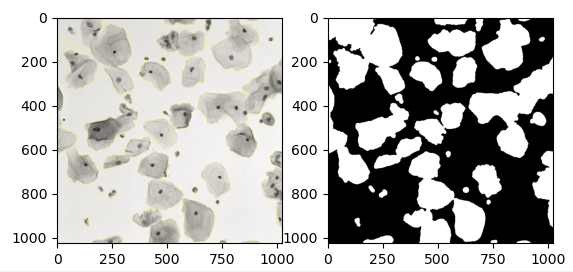 GitHub - paty237/cells-and-nucleus-segmentation-: projet d'imagerie ...