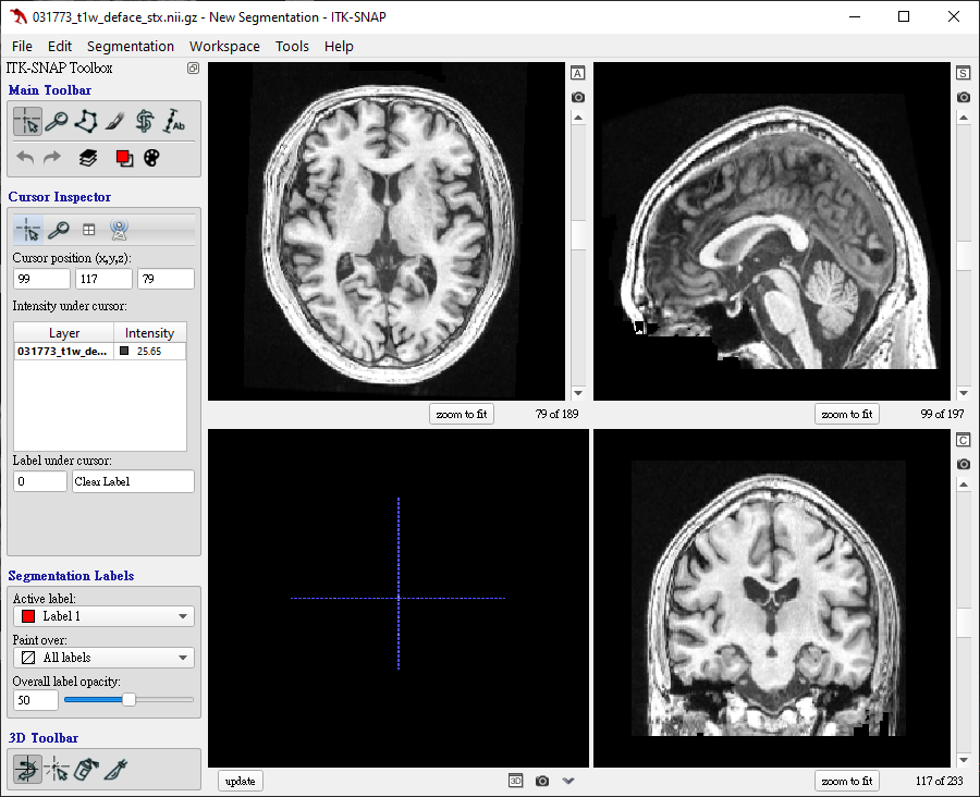 boolear index error · Issue #14 · cwmok/LapIRN · GitHub