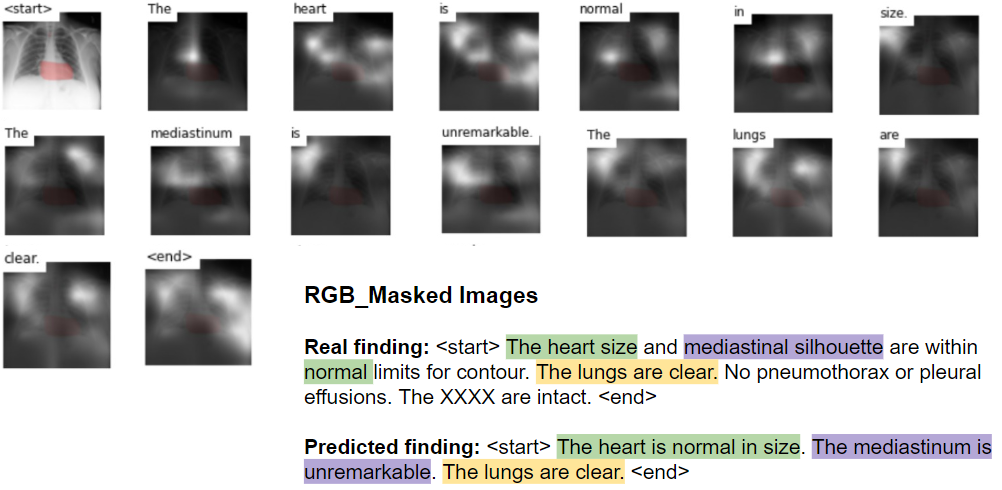 GitHub - LiuliuChen/AIMR-MediTell: This is the repo for EE641.