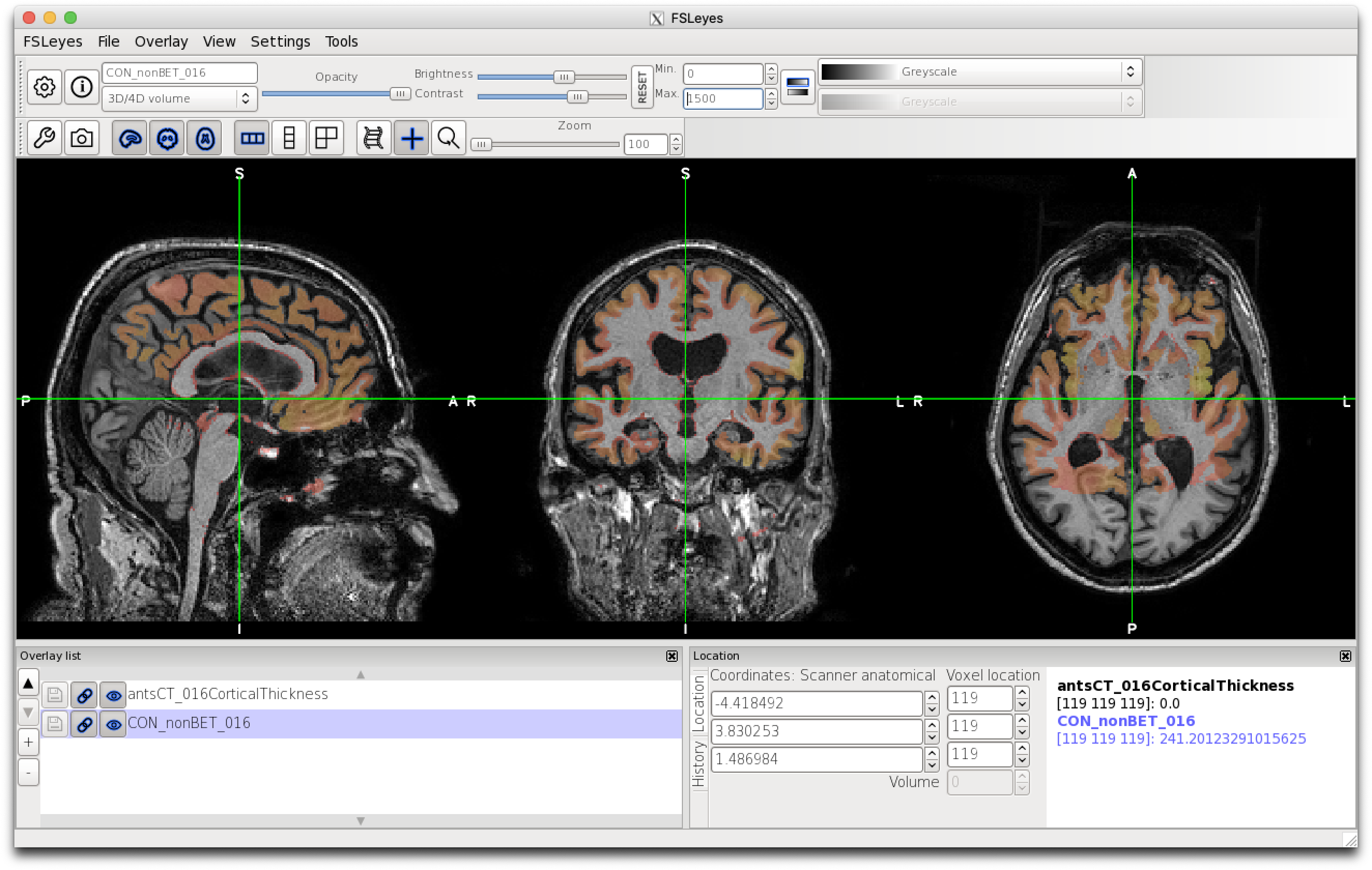 Cortical Thickness Issue · Issue #990 · ANTsX/ANTs · GitHub
