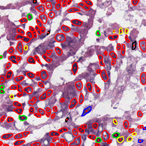 cannot run run_infer.by command · Issue #82 · vqdang/hover_net · GitHub