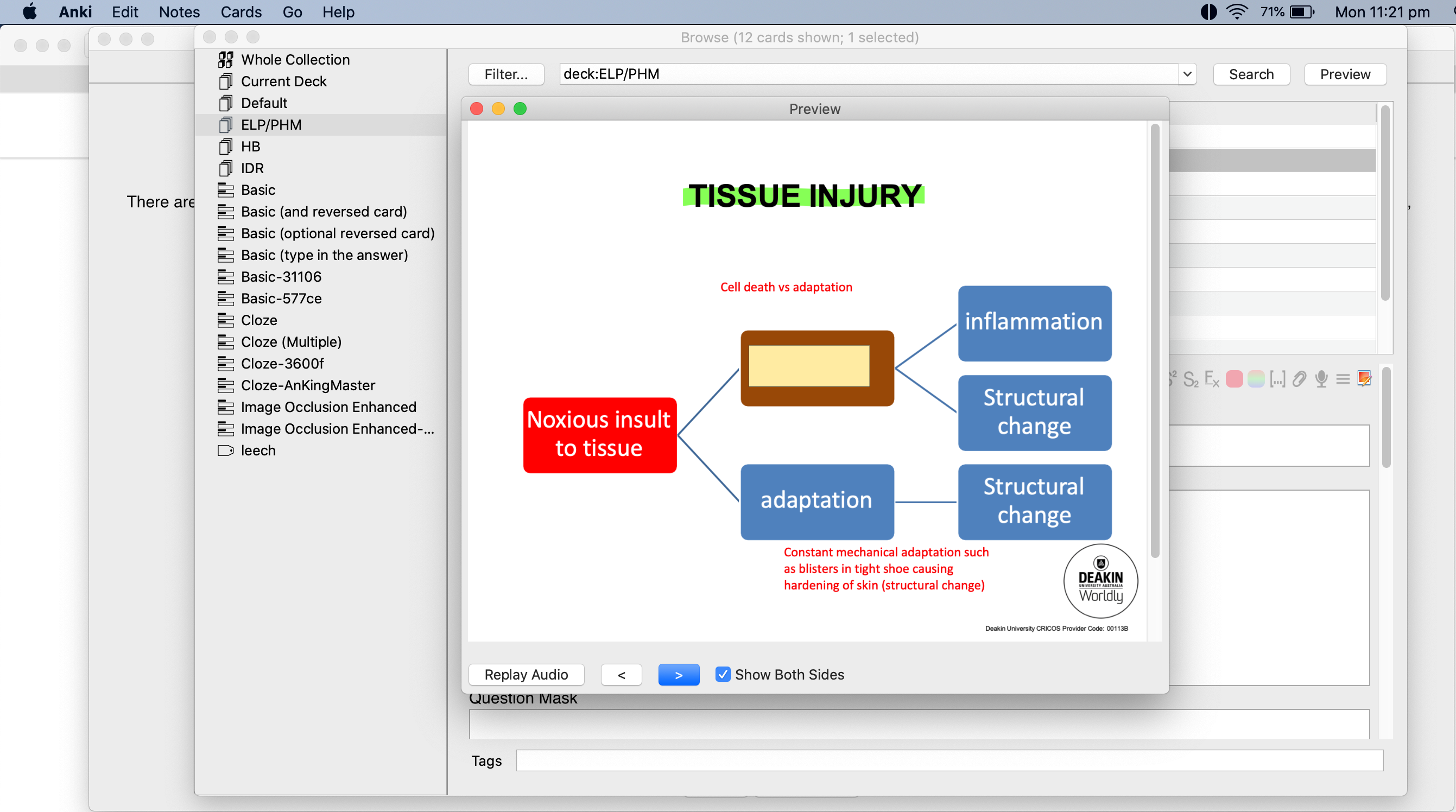 Cannot make new image occlusion card · Issue #144 · glutanimate/image-occlusion-enhanced · GitHub