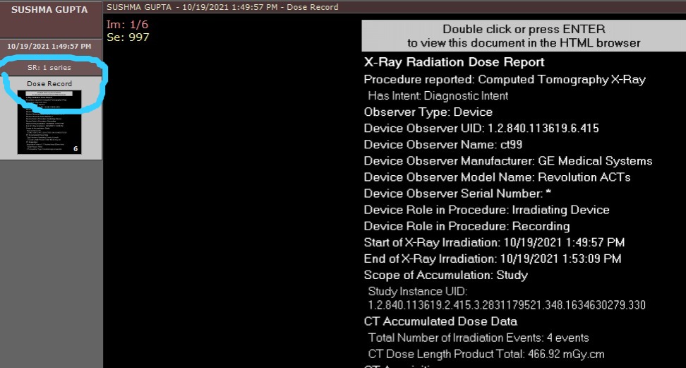 Dose Record structure report Not Loading in Cornerstonejs library(OHIF VIEWER) · Issue #2589 ...
