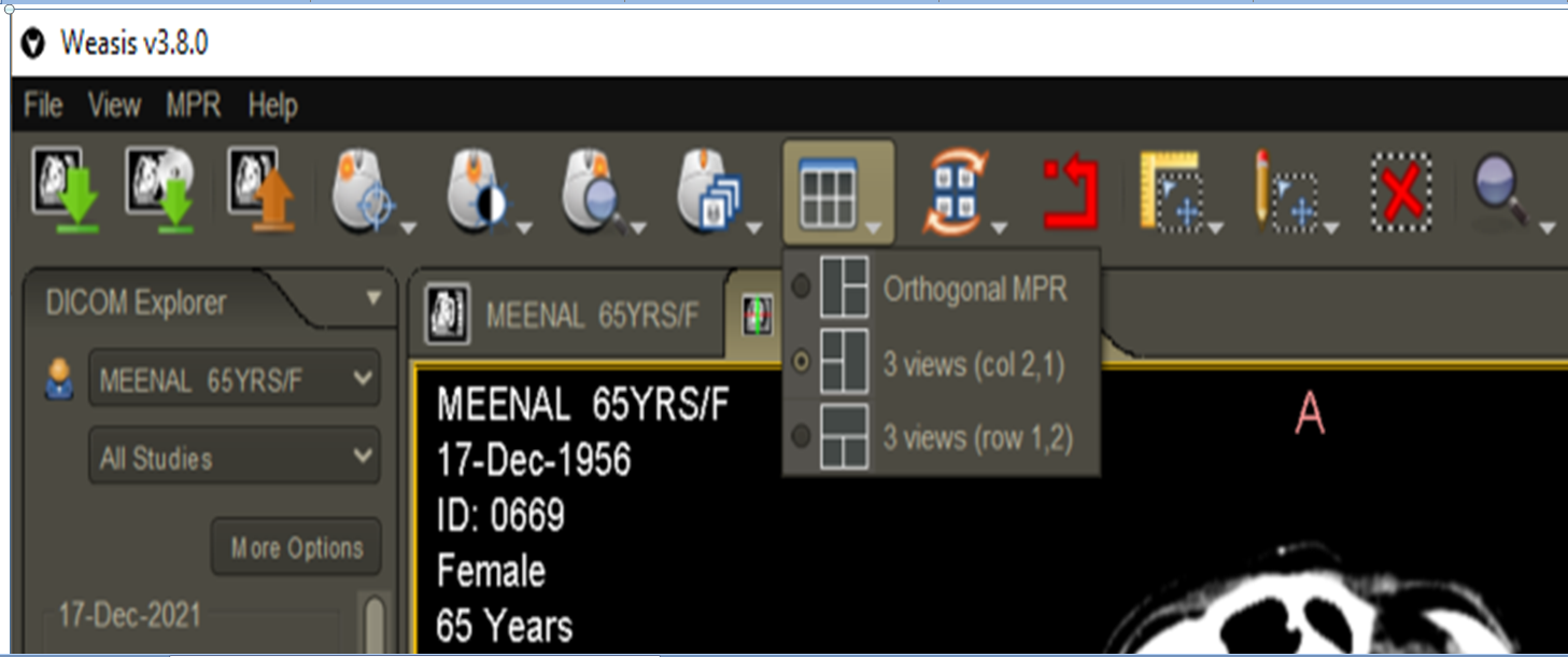 Add new default layouts for panoramic screens and MPR · Issue #229 · nroduit/Weasis · GitHub