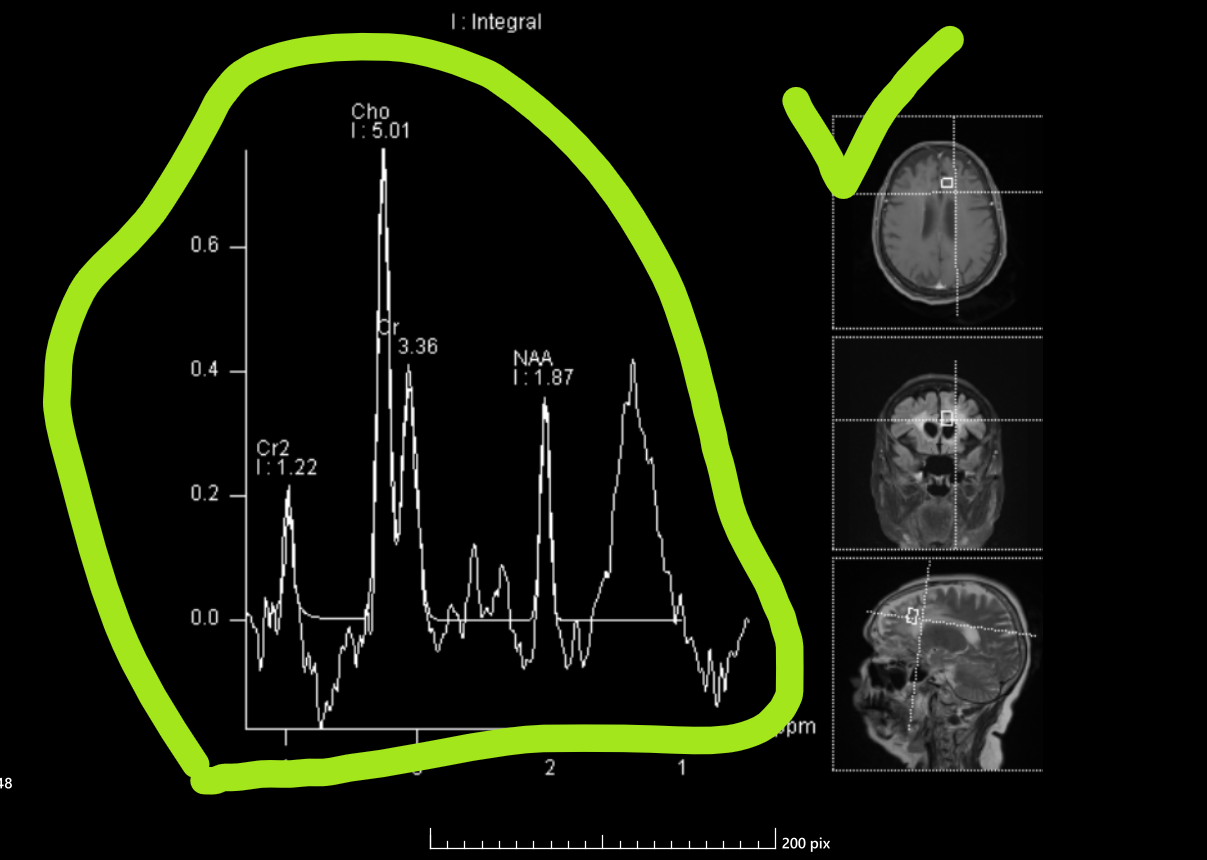 Mri Spectrocopy Image Not Receiving · Issue 1517 · Fo Dicomfo Dicom · Github 