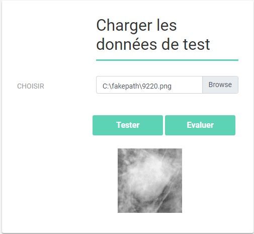 Github Jouhaina Nasri Breast Cancer Detection Breast Cancer