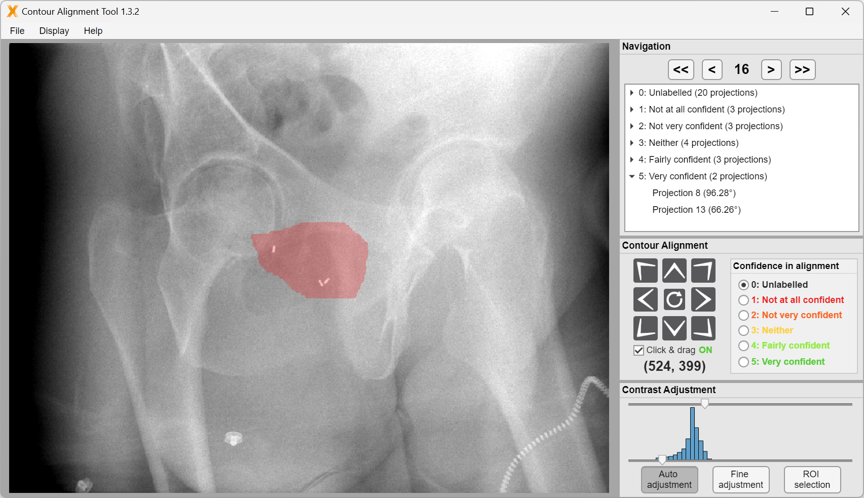 Github Image X Institute Contour Alignment Tool Application For The Manual Alignment Of