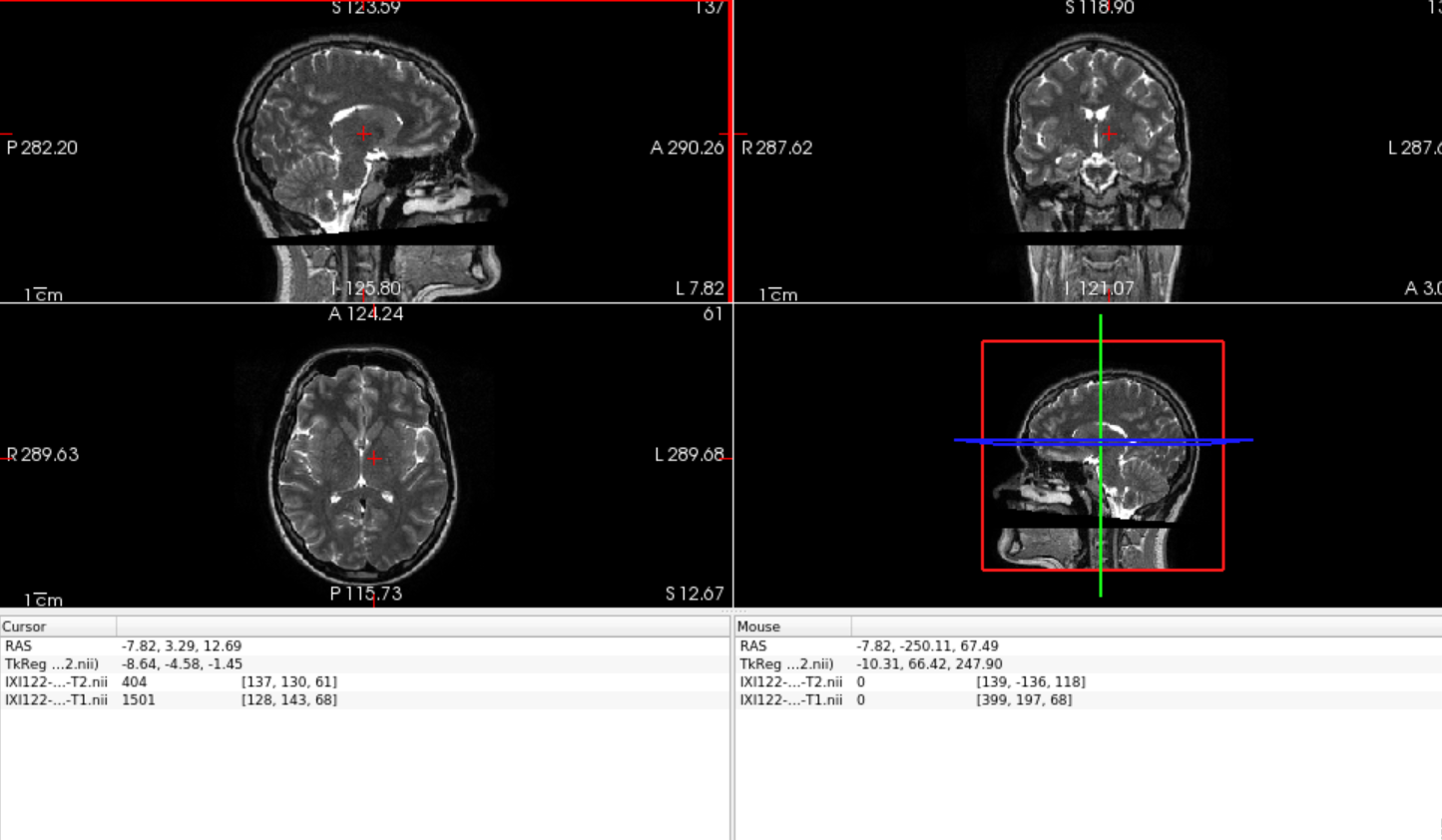 TMS optimization · Issue #62 · simnibs/simnibs · GitHub