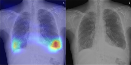 GitHub - sckim0430/Chest-Xray-Classification