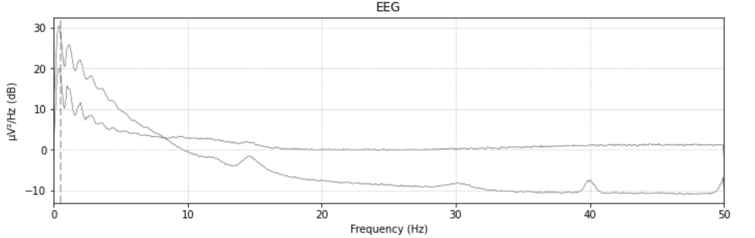 GitHub - 20180104Rana/Sleep_Physionet-Age-Dataset-_BCI-Project