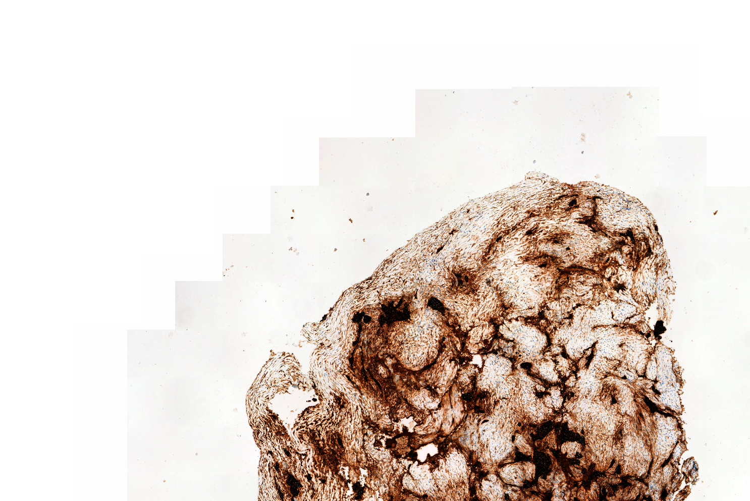 Image artifacts in mrxs slide from 3dhistech DX software · Issue #432 ...