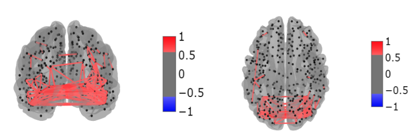 GitHub - avisha-04/nma-project-hcp-fmri-emotions-task: This was a group ...