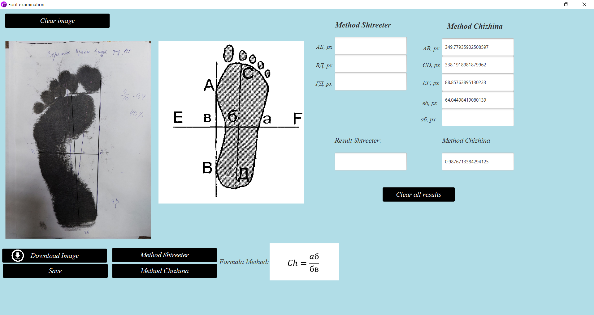 GitHub - Violetta179/Foot-examination: An application that helps to ...