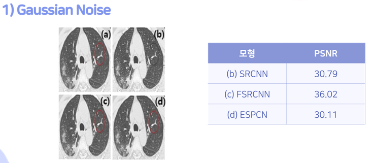 GitHub - I-SUBIN/CTimage_Denoising_usingDeeplearning