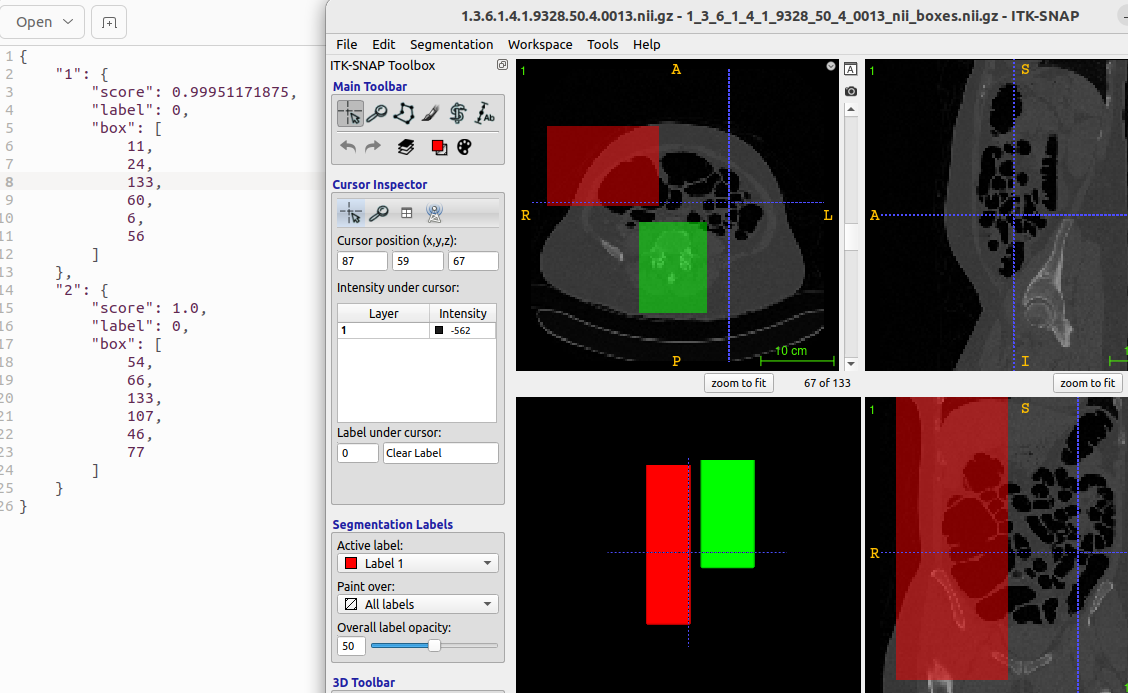 [Question] big object across patches · Issue #147 · MIC-DKFZ/nnDetection · GitHub