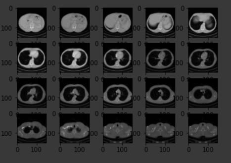 GitHub - raju6/LungCT_Diagnosis: This repository processes CT scan ...