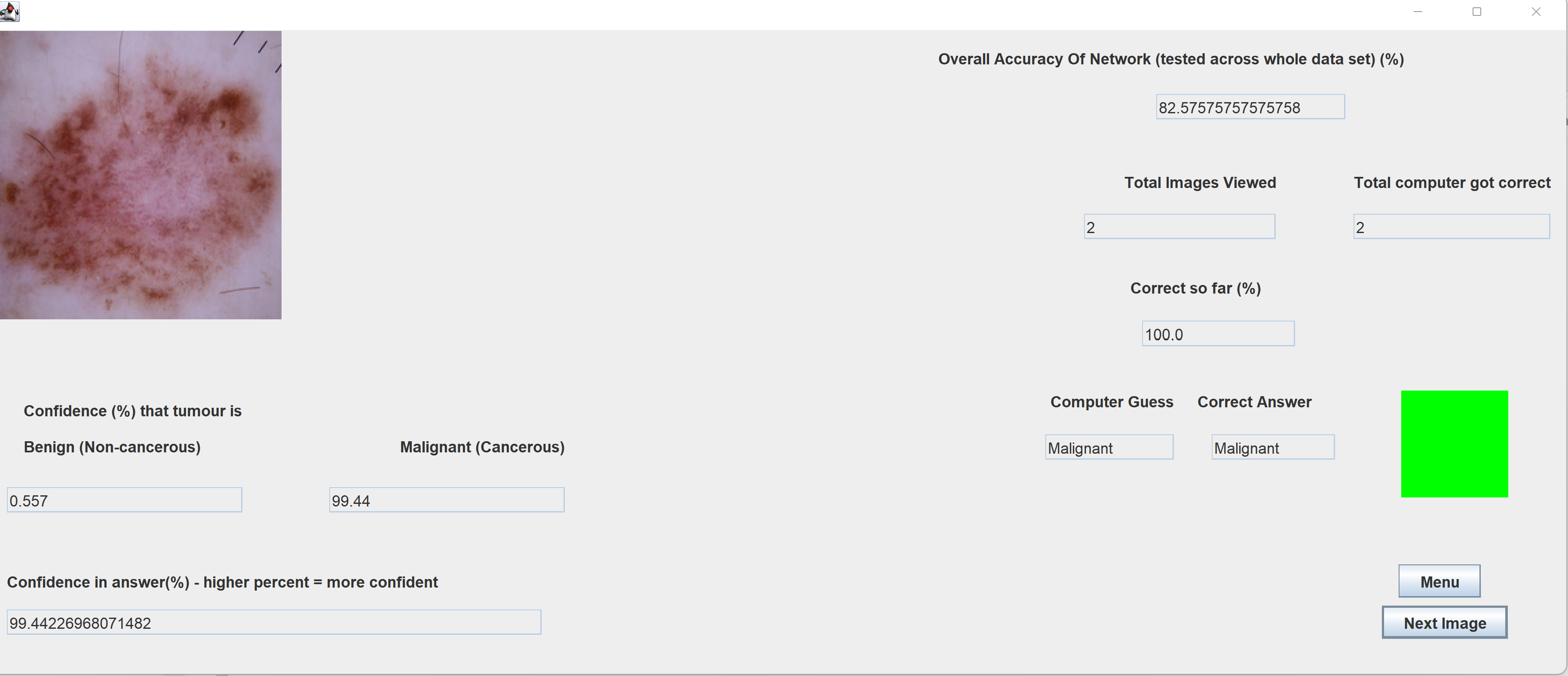 GitHub - philipmortimer/Tumour-Classification: Application of my Java ML library to identify ...