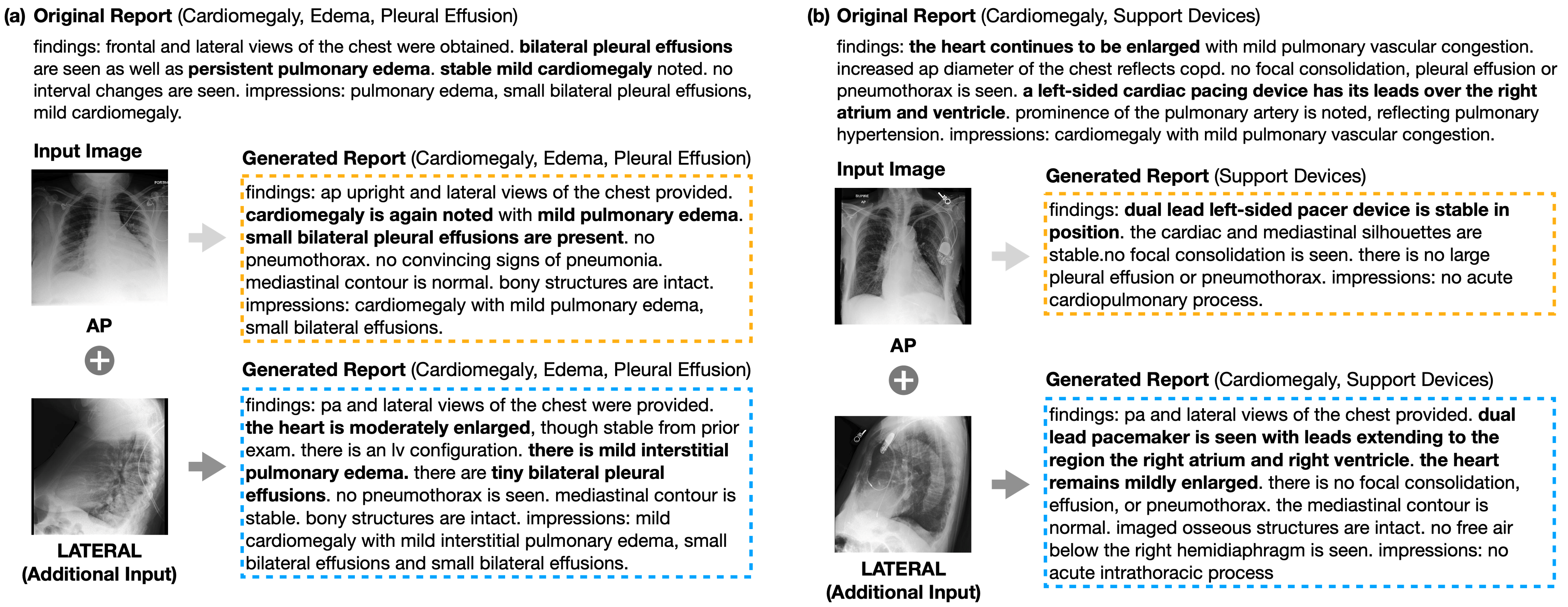 GitHub - ttumyche/UniXGen: Code for the paper: "Unified Chest X-ray and ...
