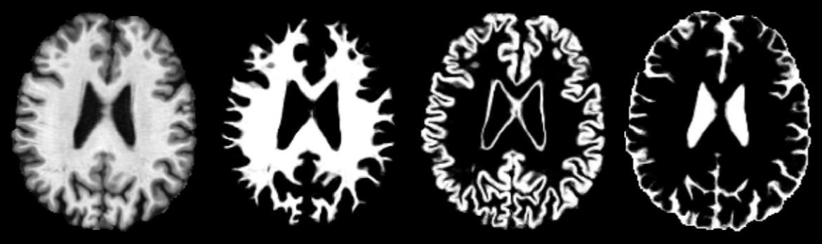 GitHub - DBC-Lab/Sparse-representation-for-brain-image-segmentation ...