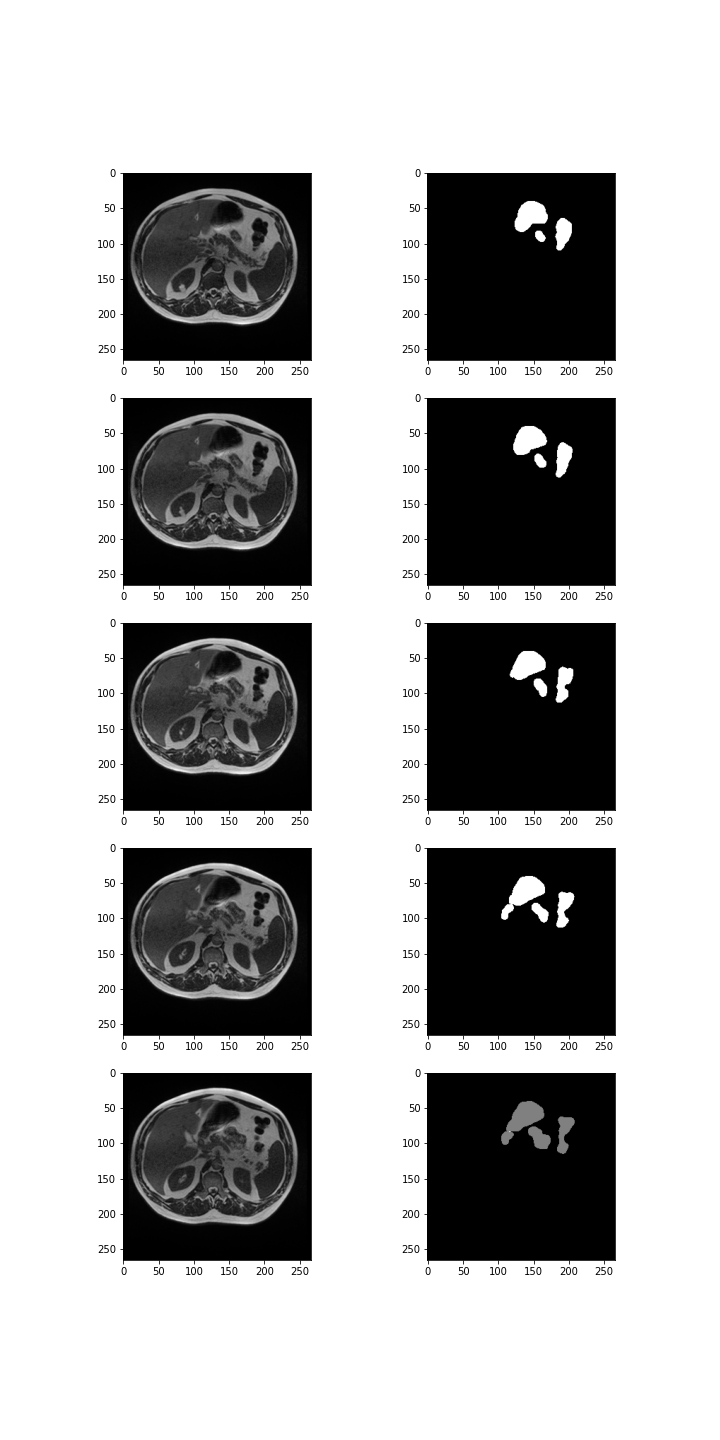 GitHub - pri1311/UWM-GI-Tract-Image-Segmentation: https://www.kaggle ...