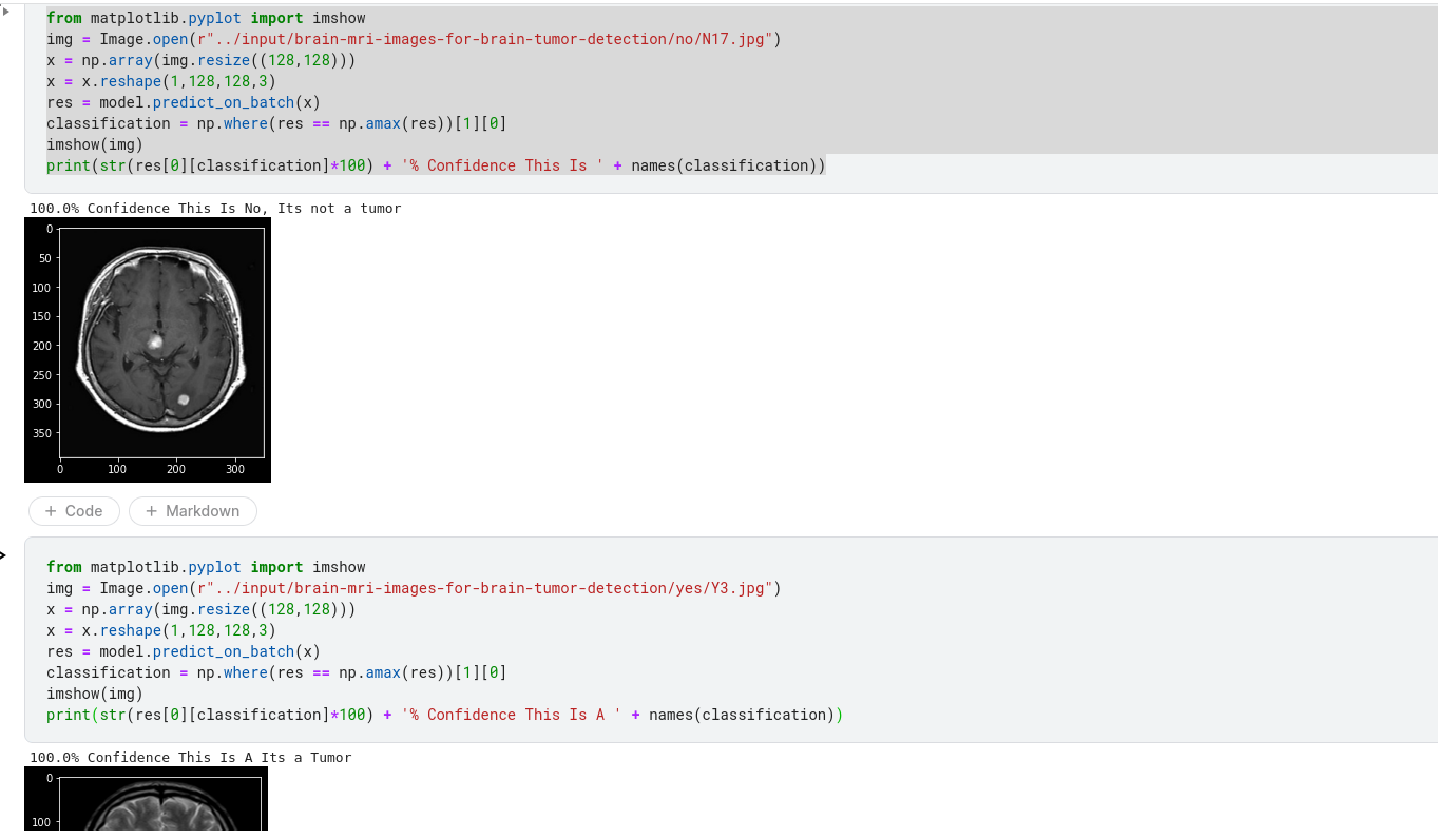 GitHub - Arman170616/Brain-Tumor-Classification-with-Tensorflow-and-Keras