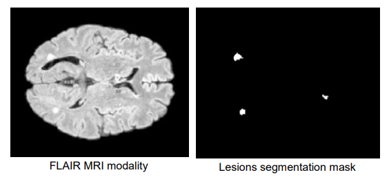 GitHub - Matan22g/Classification-of-brain-MRI-voxels: Implementation of ...