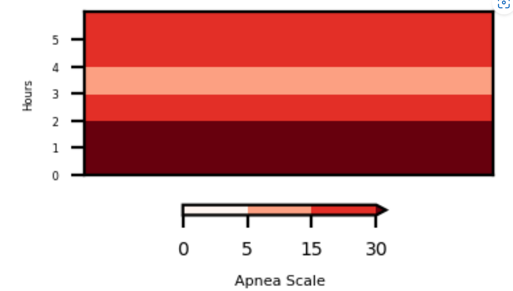 L3-apnea-AI | Sleep apnea prediction tool for hospitals.