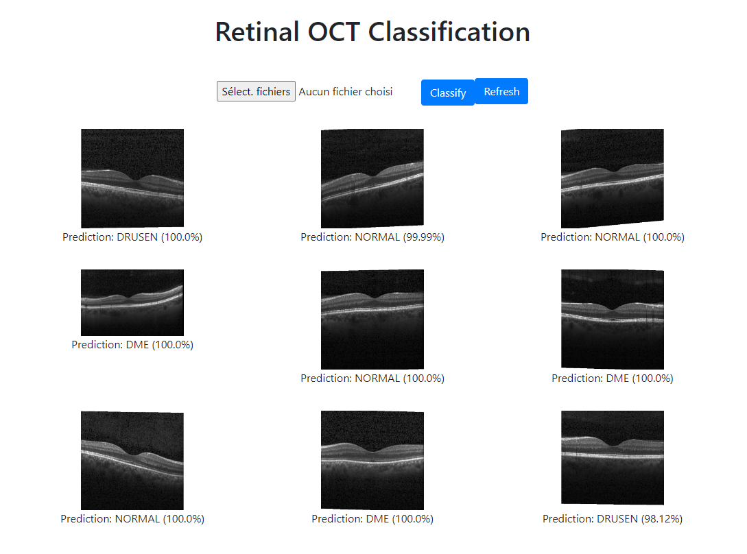 GitHub - AranOribu/retinal-oct-classification