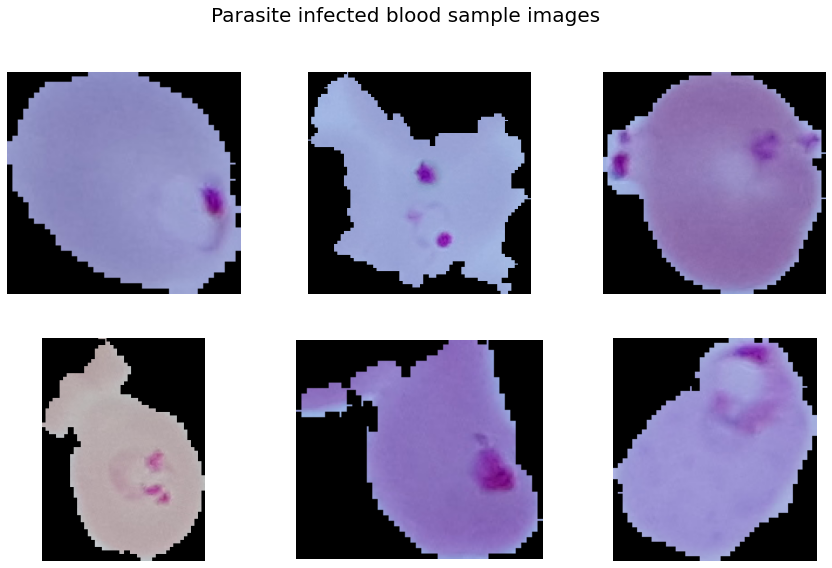 GitHub - kresnandika/Malaria-Cell-image-classification-CNN: In this ... GitHub - kresnandika/Malaria-Cell-image-classification-CNN: In this ...
