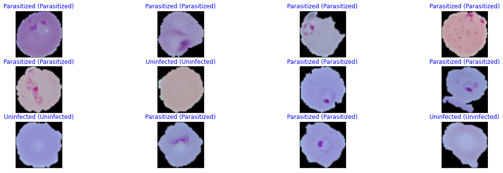 GitHub - kresnandika/Malaria-Cell-image-classification-CNN: In this ...